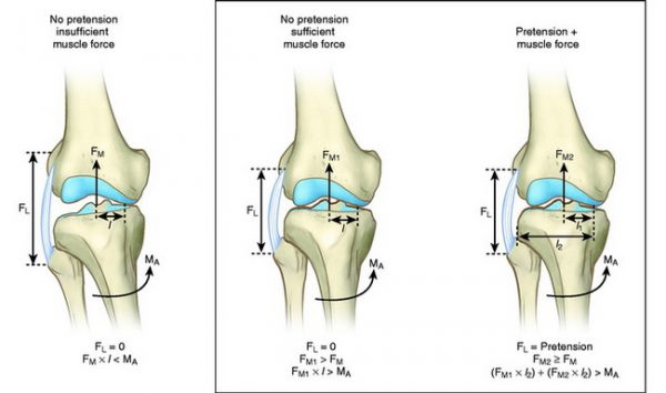 Knee Varus -- Diagnosis and Hazards | Orthotics Insoles & EVA Supplier ...