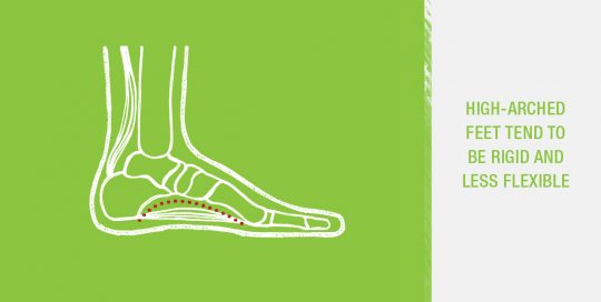 High Arches Explained | Orthotics Insoles & EVA Supplier | Ideastep